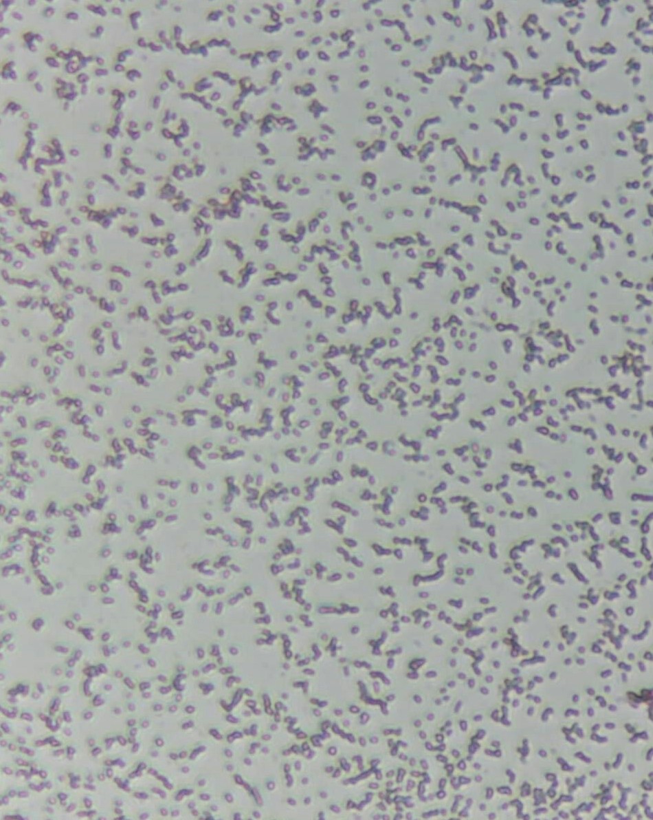 Monumental Microbes Part 2 – The Official Blog of Edvotek®