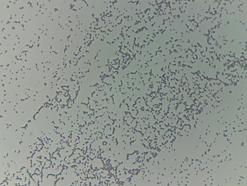 Tips on Making Bacterial Slides – The Official Blog of Edvotek®