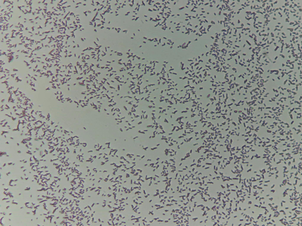 Tips on Making Bacterial Slides – The Official Blog of Edvotek®