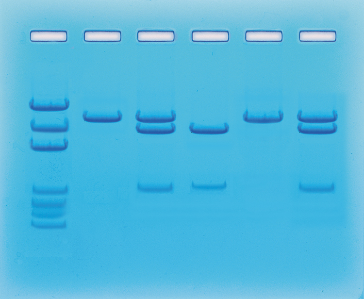 EdvoTech Tips: Using a DNA Ladder – The Official Blog of Edvotek®