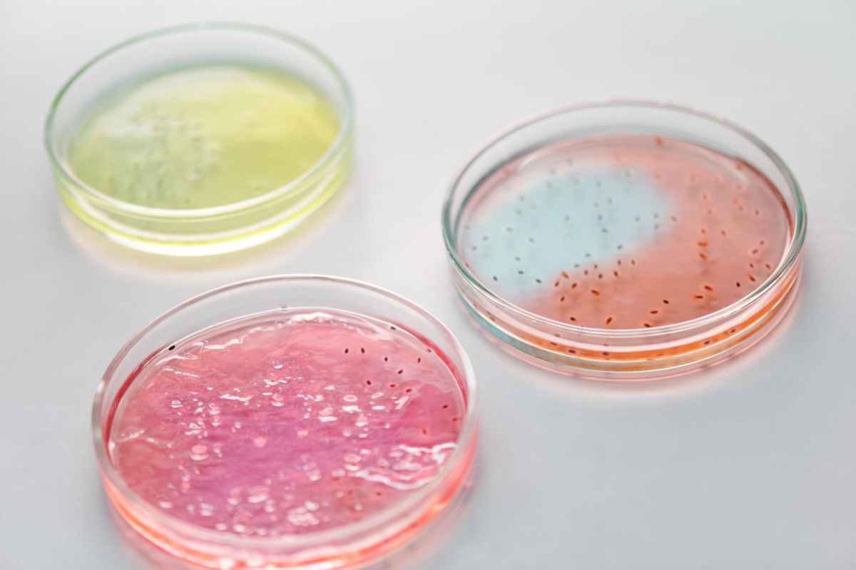 The Agar Art Contest: Science as Art – The Official Blog of Edvotek®