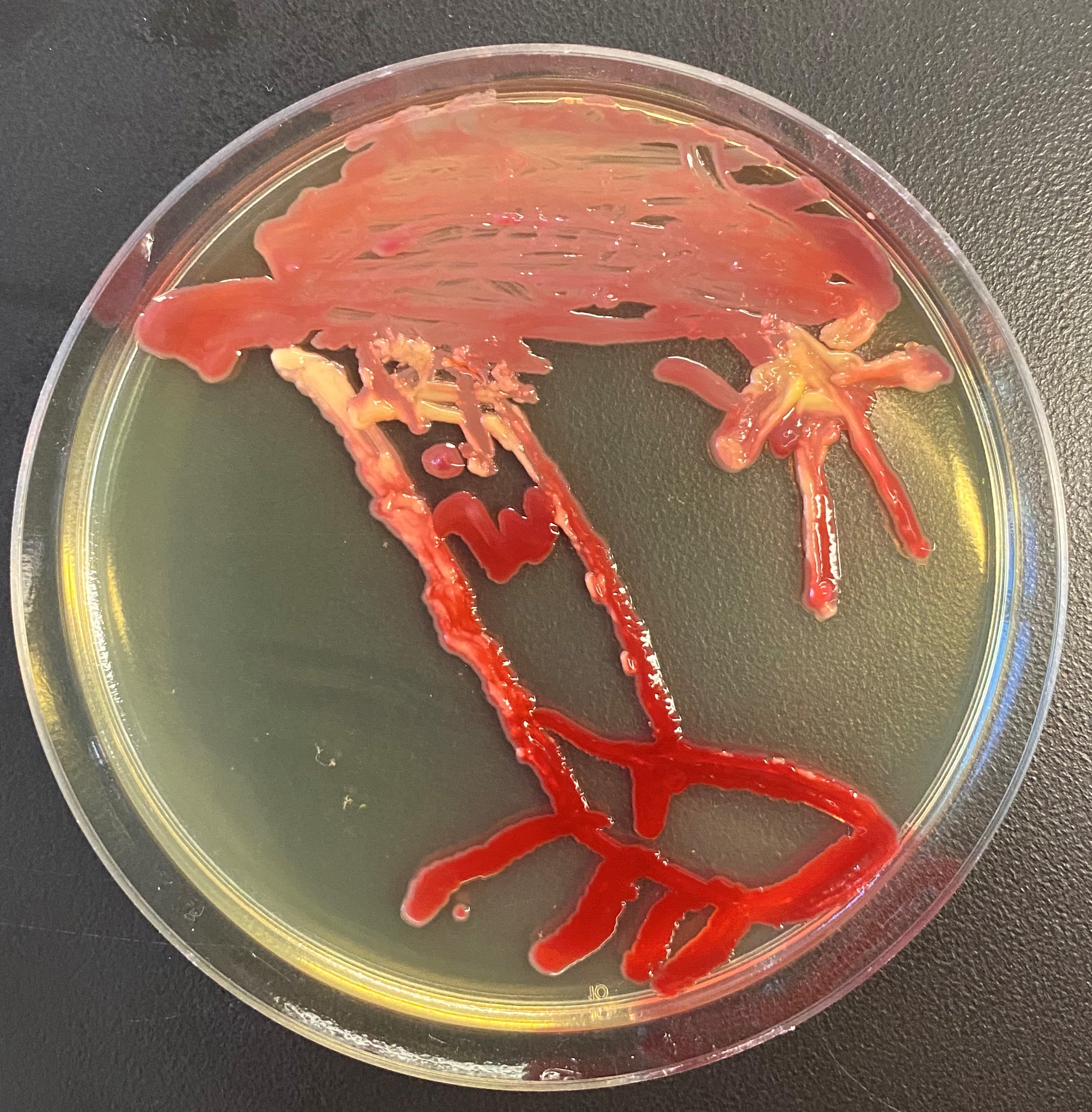 Announcing the 2021 American Society for Microbiology Agar Art Contest ...