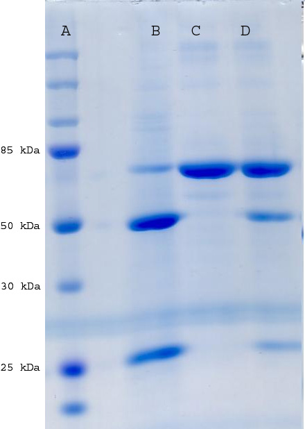 Biotech Basics: Staining Proteins – The Official Blog of Edvotek®