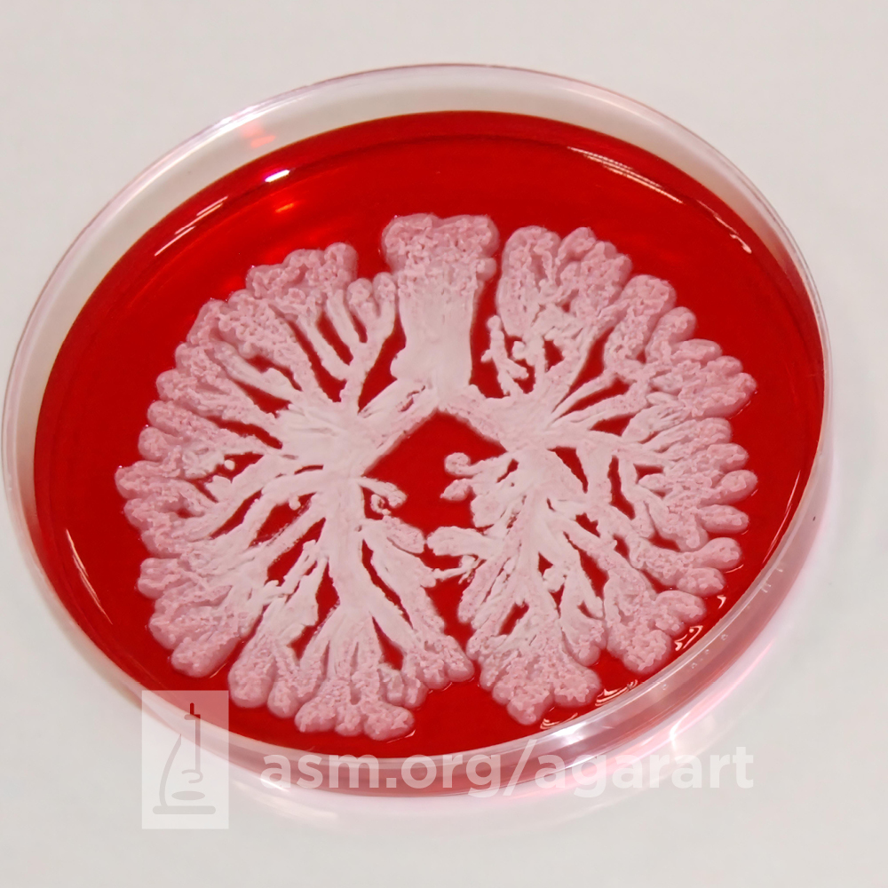 You’re Invited to Participate in This Year’s Agar Art Contest! – The ...