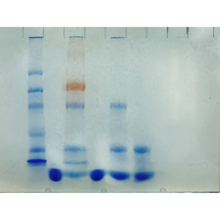EdvoTech Tips: How to choose the correct DNA ladder – The Official Blog ...