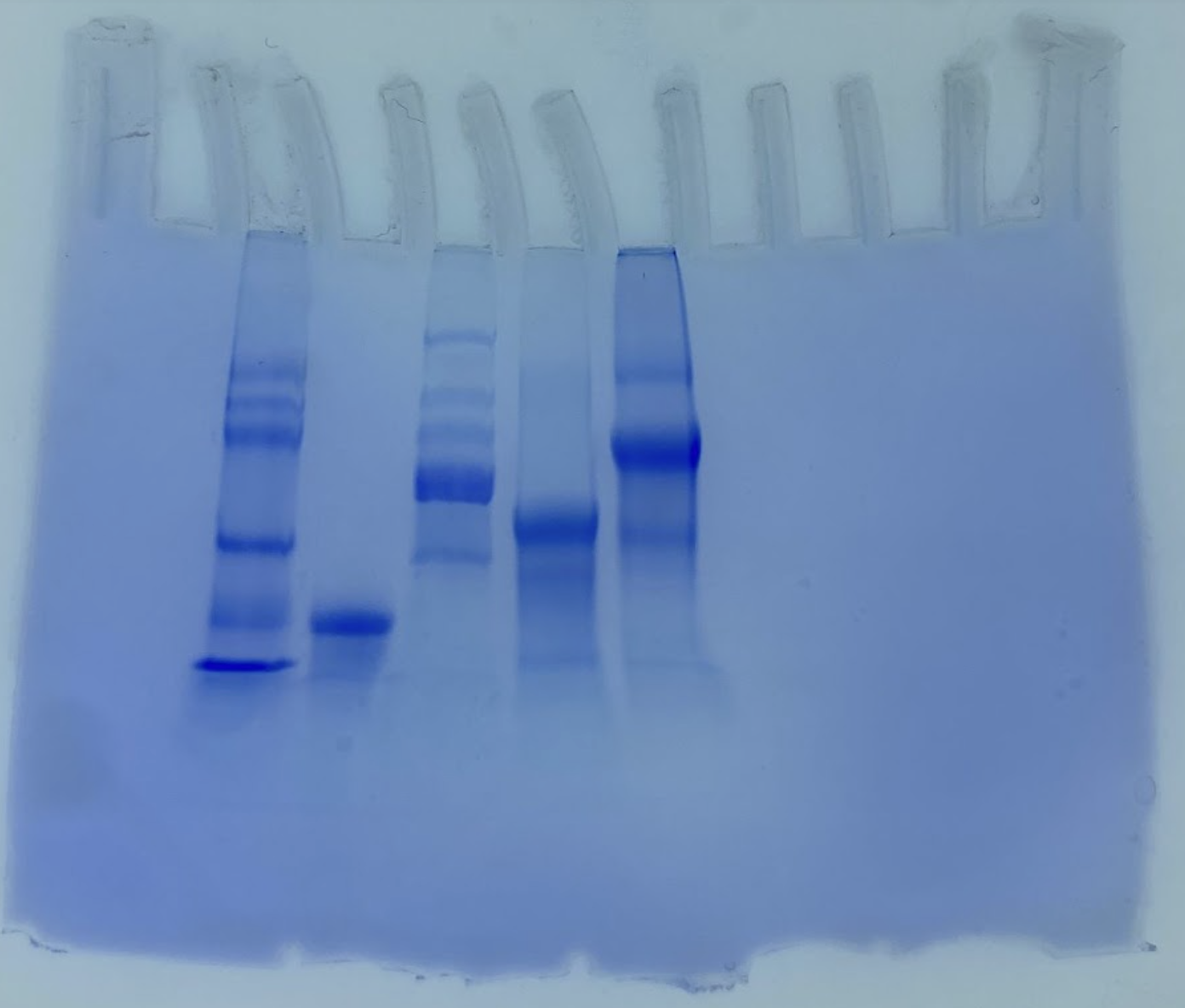 Protein Staining like a Pro – The Official Blog of Edvotek®